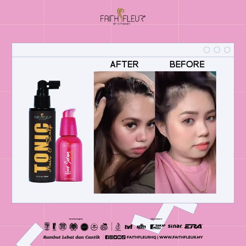 READY STOCK PELEBAT RAMBUT, RAWAT RAMBUT GUGUR [MELEBATKAN ...