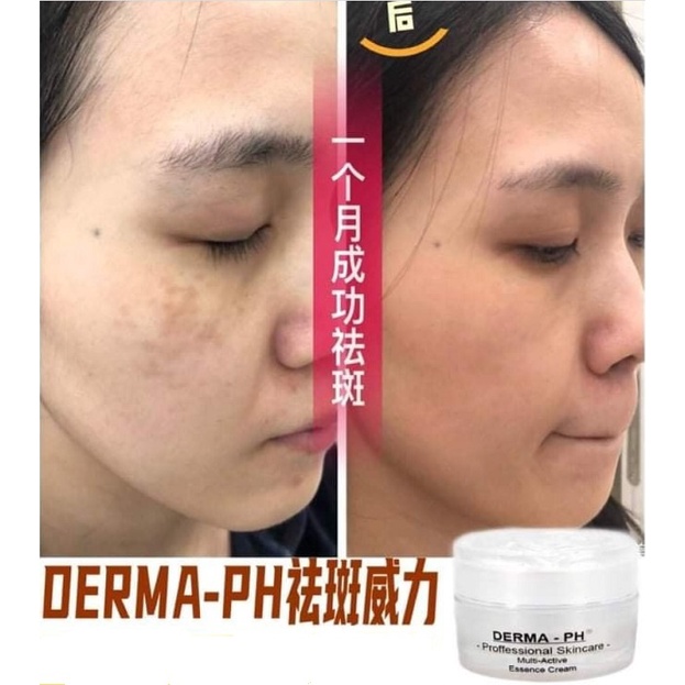 FREE FACE MASK - DERMA PH - Professional Skincare Original from S'pore ...