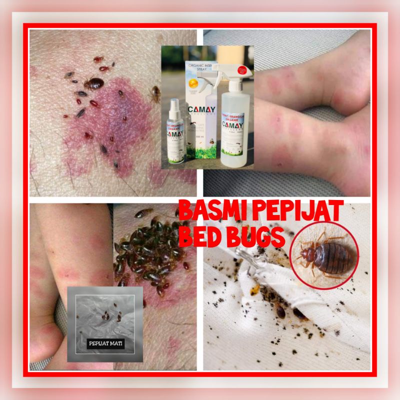 CAMAY SPRAY - NON-ODOUR SPRAY PEPIJAT | UBAT PIJAT HAMA TILAM | BEDBUGS ...
