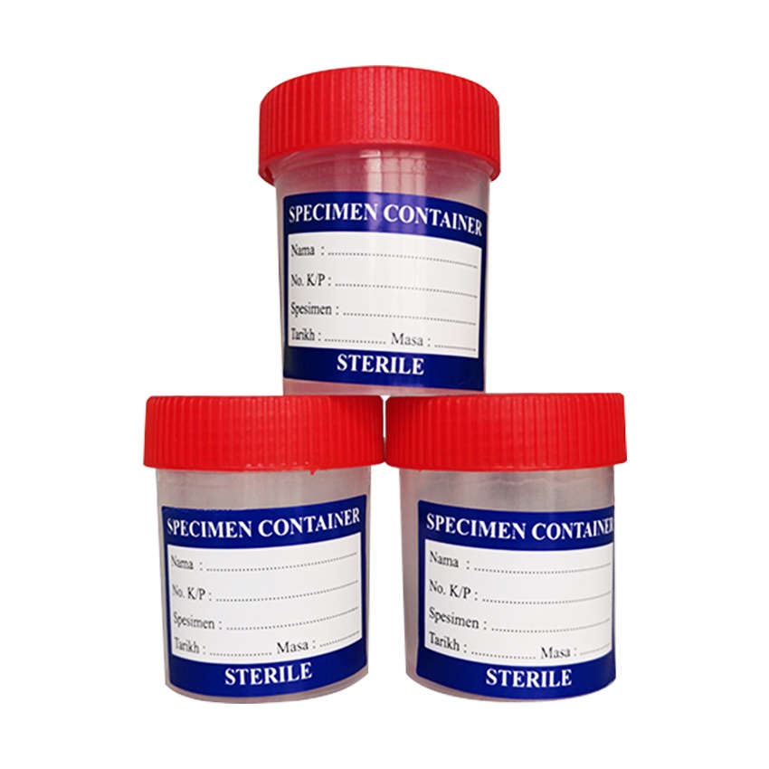 Sample / Specimen / Urine Container, 60ml, Sterile | Shopee Malaysia