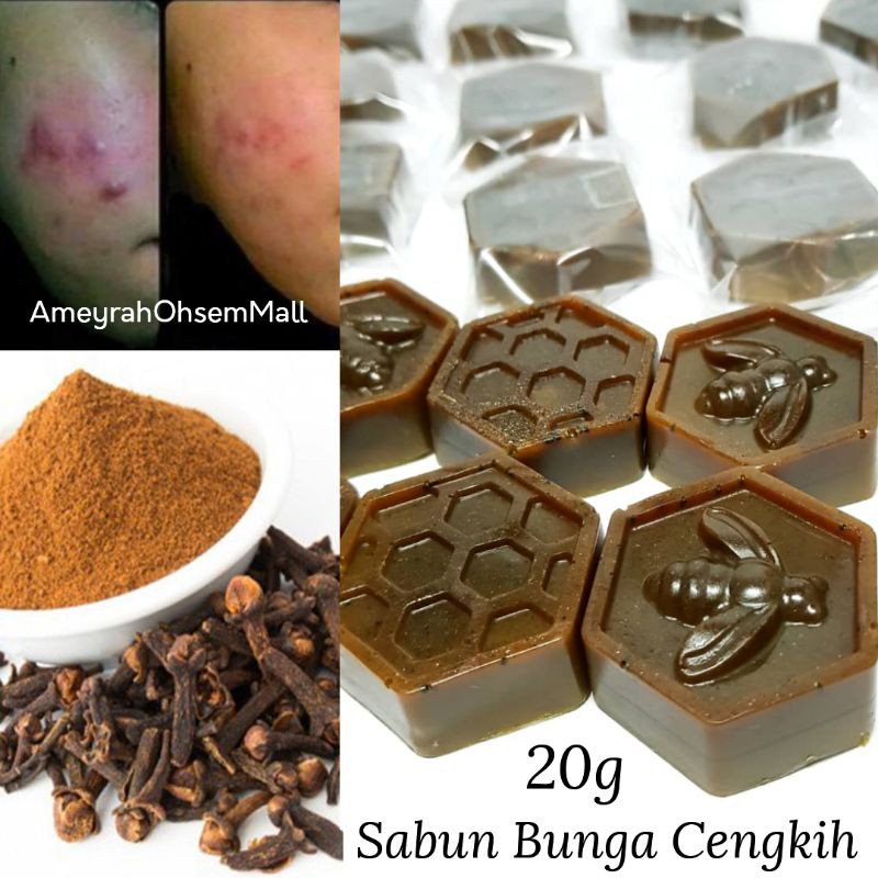 Jerawat/ Resdung/ Sabun Bunga Cengkih 20g/ Muka Moist/ Keradangan Kulit ...