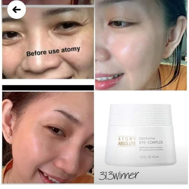 Atomy Absolute Spot out cream 50ml 艾多美煥膚精華除斑霜 - Solve blemishes ...