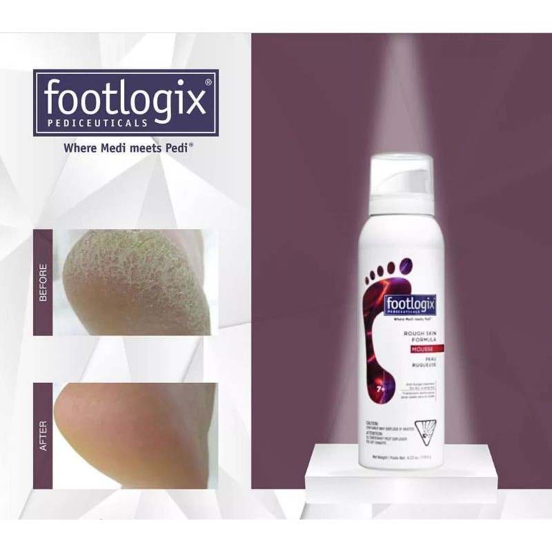 [READY STOCK] FOOTLOGIX ROUGH SKIN FORMULA | Shopee Malaysia