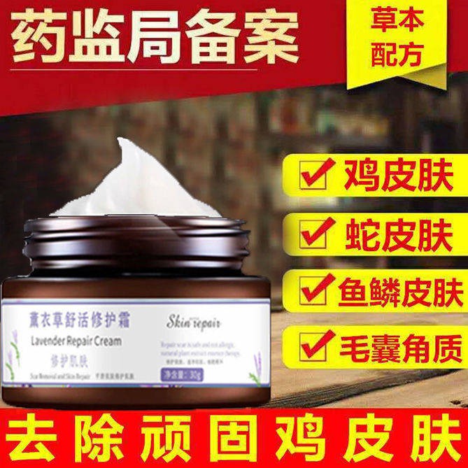 Up diamond ♝Herb to chicken skin fish scales skin snake skin cream ...