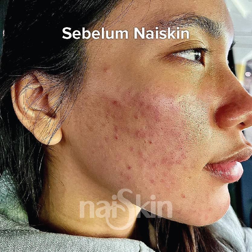 Naiskin, Online Shop | Shopee Malaysia