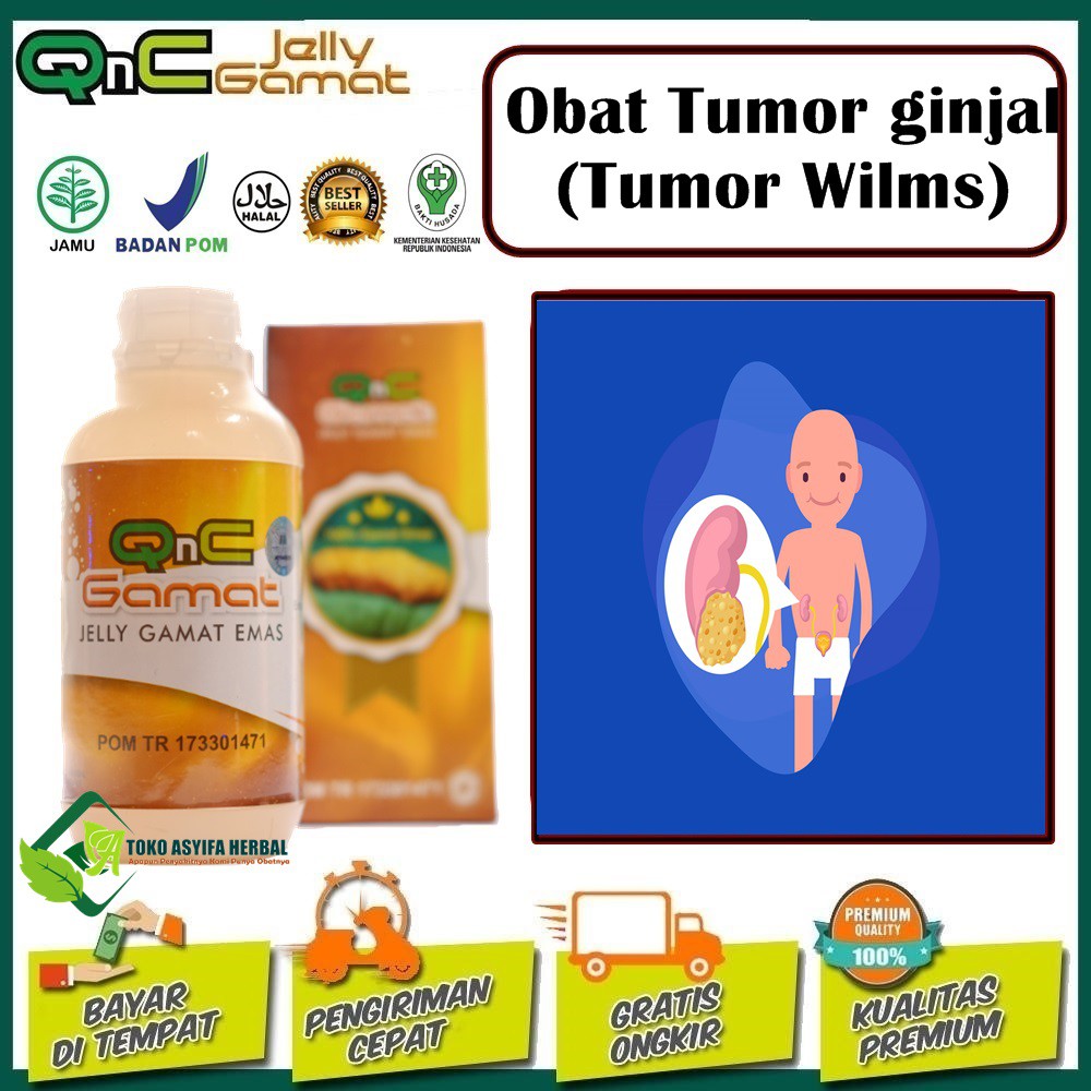 Kidney Tumor Medicine (wilms Tumor Medicine) In Children & Adults - Qnc ...