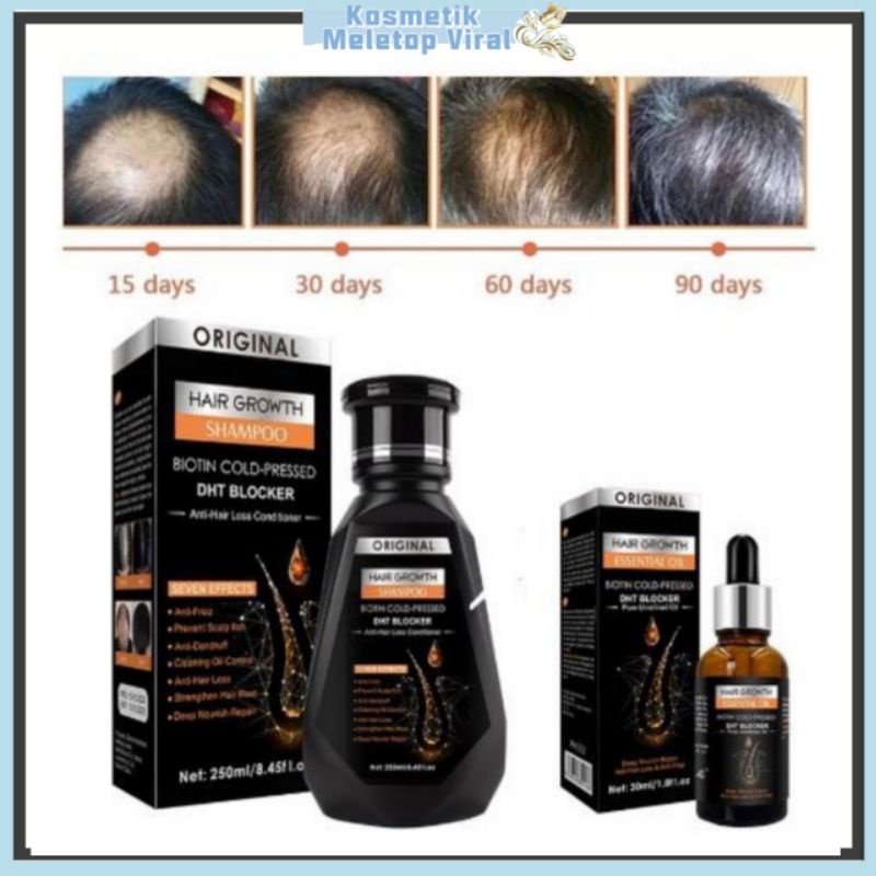 PEI MEI Hair Growth Shampoo/ Essential Oil Anti-Hair Loss | Shopee Malaysia