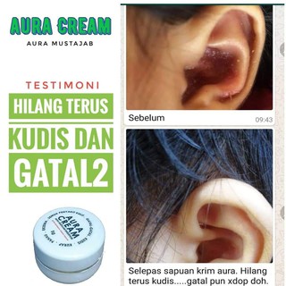 AURA CREAM AURA MUSTAJAB - RAWAT KURAP, KUDIS, GATAL2, PANAU, EKZEMA ...