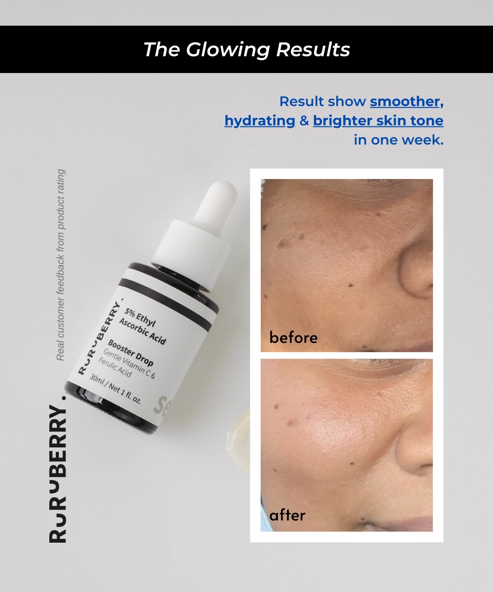 Ruruberry Official Online, November 2022 | Shopee Malaysia