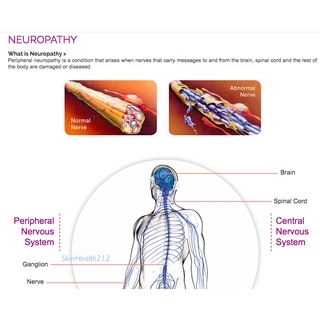 BIONERV Tablets Alpha Lipoic Acid (ALA) + Vitamin B Complex) (60's ...