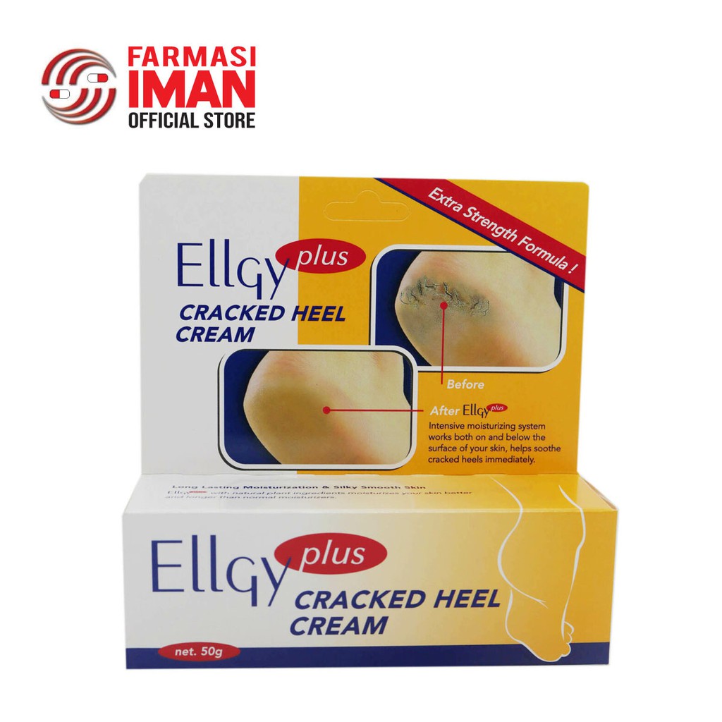Ellgy Plus Cracked Heel Cream 50g | Shopee Malaysia