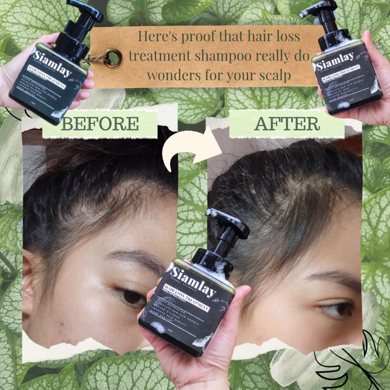 Herbal shampoo for hair loss treatment MERAWAT MASALAH RAMBUT [Siamlay ...