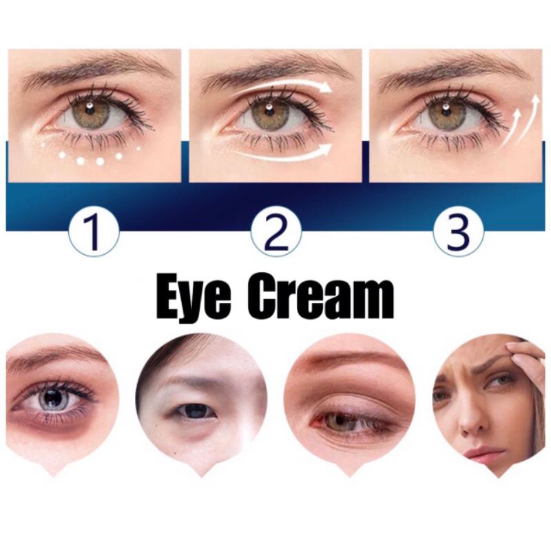 EYE CREAM CONSORT, untuk memperbaiki bawah mata bengkak, gelap, eyebag ...