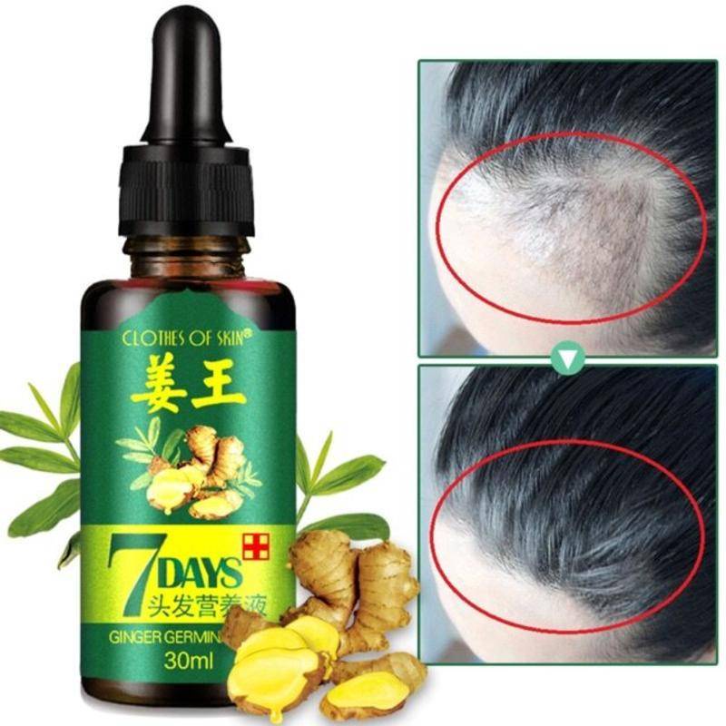 Rawatan Minyak Halia Ginger Oil Lebih Menumbuh dan melebatkan Rambut ...