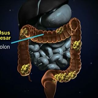 K AYULAX K LINK AYURVEDA AYU LAX KLINK DETOX USUS UBAT CUCI PERUT ...