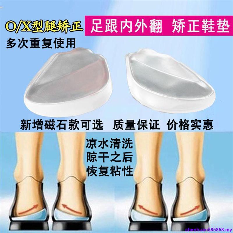 Correction of leg type o leg orthosis corrective insole half pad to ...