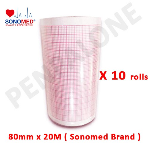 80mm x 20M - 10 rolls ECG paper ( 3 Channel ) Sonomed brand | Shopee ...