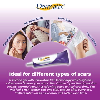 Dermatix Advanced Scar Formula Gel Hilangkan Parut Scar Treatment Body ...