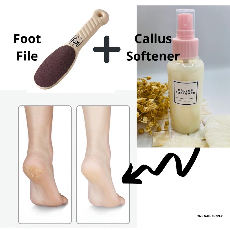 Callus Softener for Dry and Cracked heel | Callus Softener 110ml ...