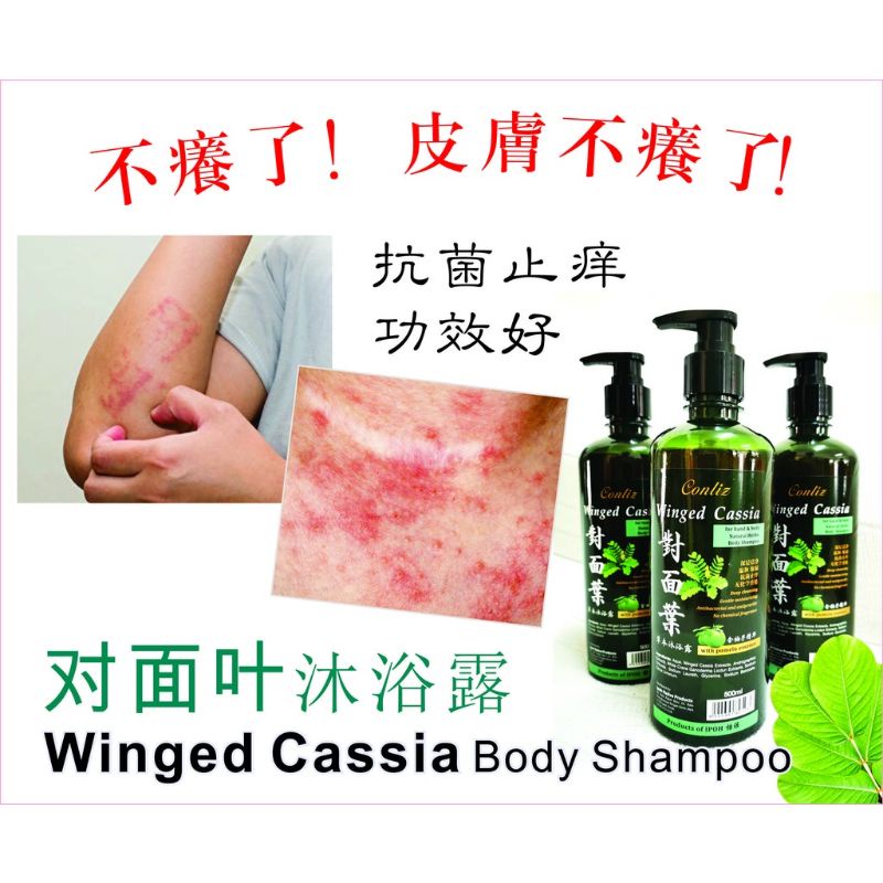 Winged Cassia shampoo(utk kegatalan kulit badan ) | Shopee Malaysia