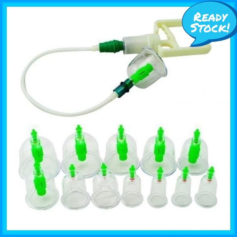 12 Cups Medical Chinese Cupping Suction Device | Shopee Malaysia