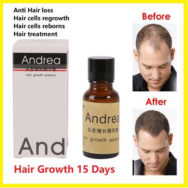 Original Andrea Hair Growth Essence Dense Anti Hair Loss Liquid Essence ...