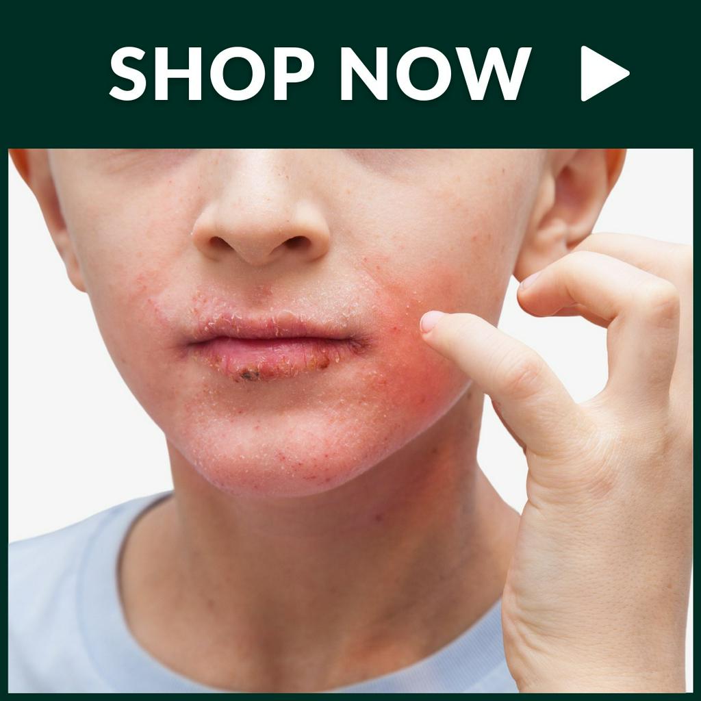 Jolicare™ Official Store, Online Shop | Shopee Malaysia