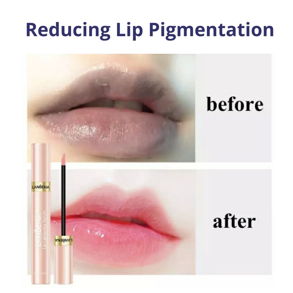 Lip Pigmentation Lightening Serum Liquid Gloss | Shopee Malaysia