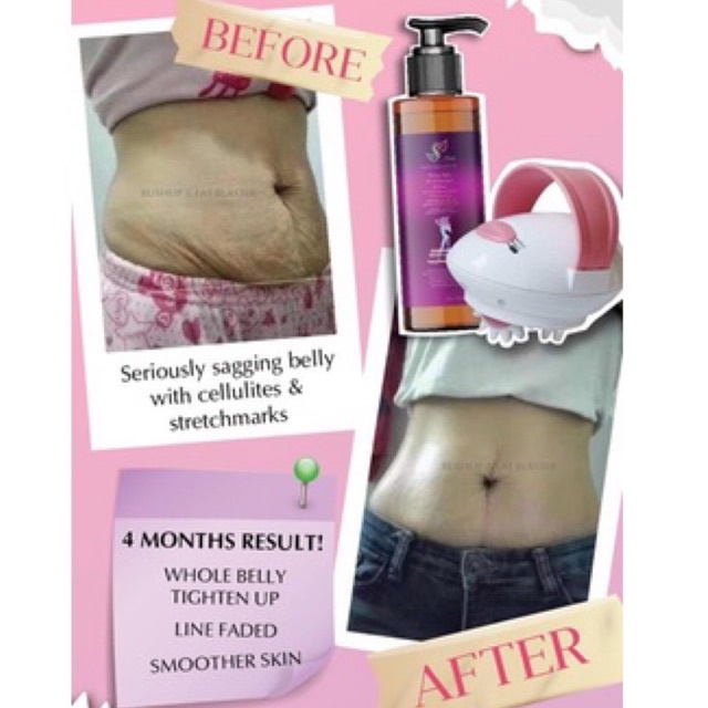 korea rushup with wireless fat blaster massager set | Shopee Malaysia