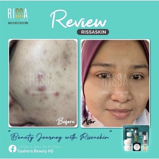 RISSA SKIN ORIGINAL HQ ( PREMIUM SKINCARE BIRD NEST ) | Shopee Malaysia