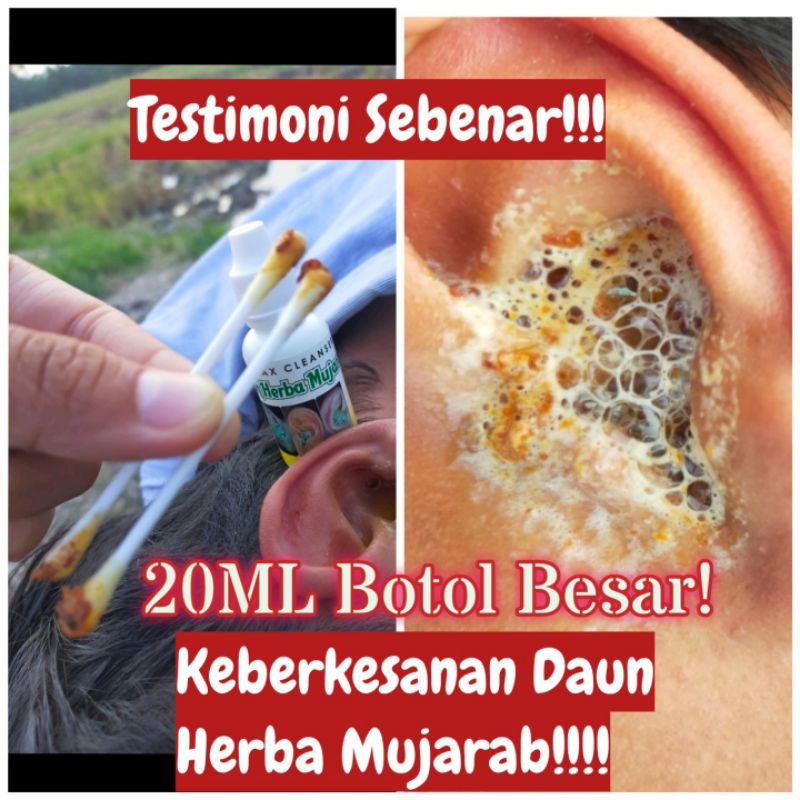 Earwax Cleanser Ubat Titis Telinga Sumbat Ubat Cuci Tahi Telinga ...