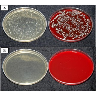 Trypto-Casein Soy Agar (TSA) Microbiology Diagnostic Reagent 160 gram ...