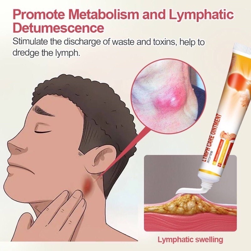 LYMPH CARE OINTMENT CREAM penghilang lemak ketiak leher dan seluruh ...