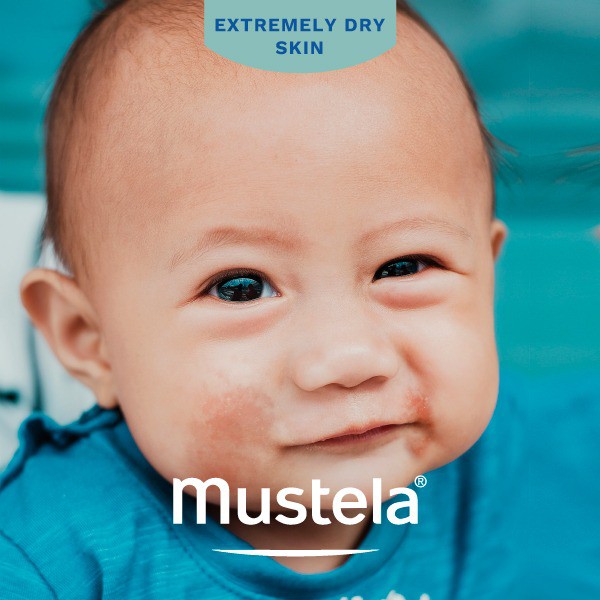 Mustela Official Store, Online Shop | Shopee Malaysia
