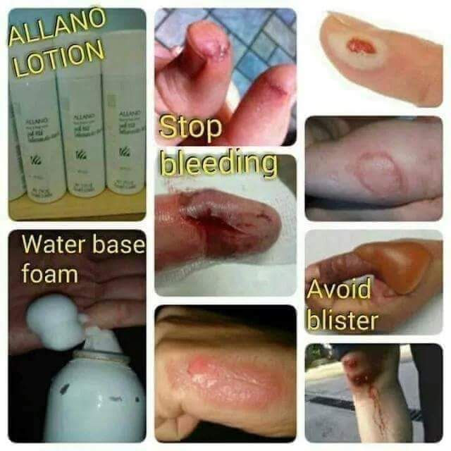 Amway Alano Lotion (Multi purpose use) | Shopee Malaysia