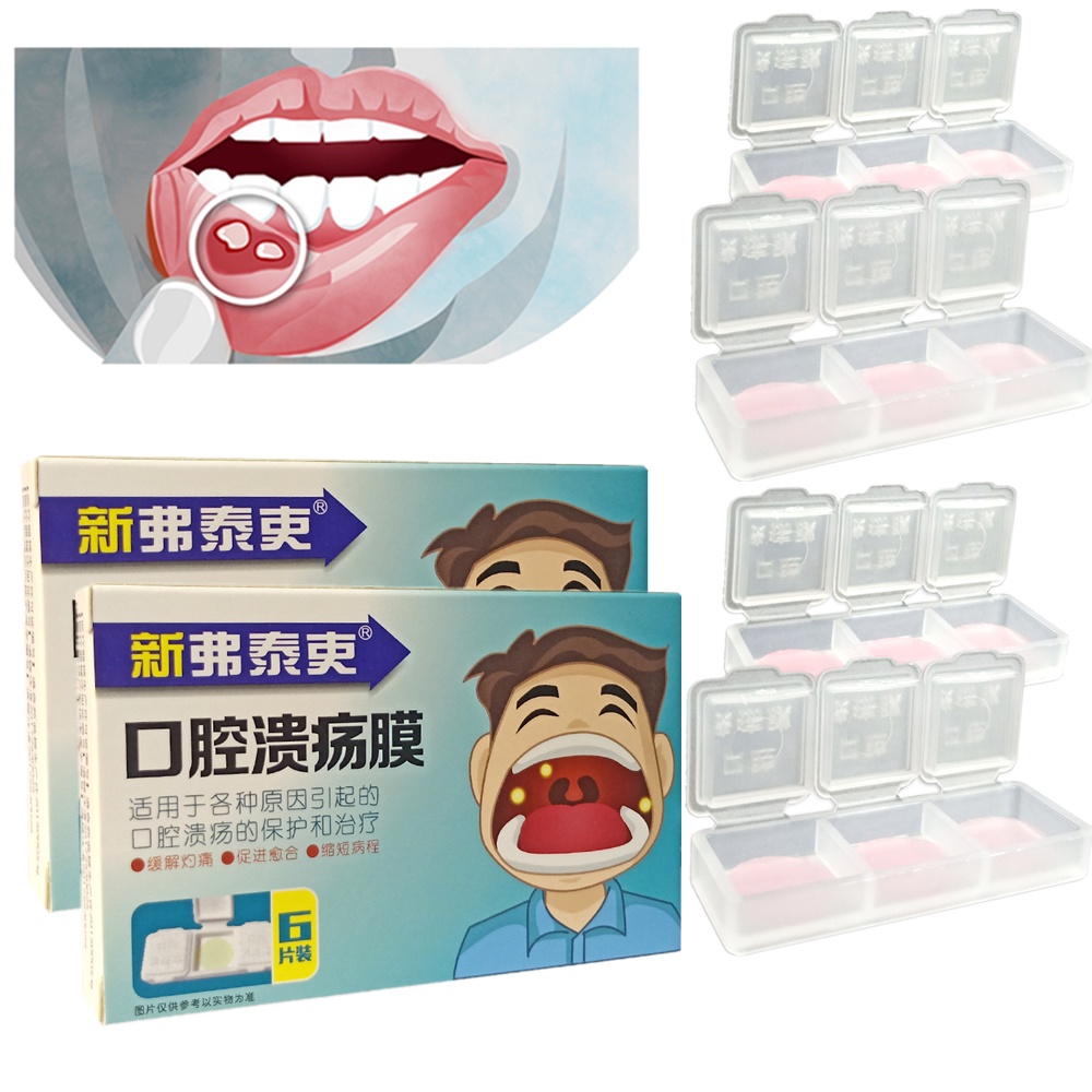 Oral Ulcers Patch 12pcs/2boxes Relief Severe Pain Irritation Canker ...