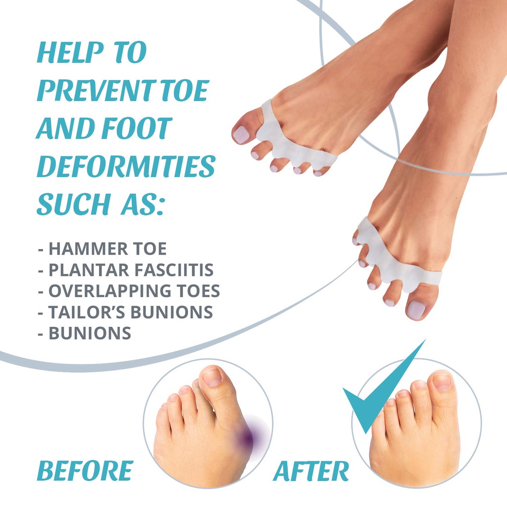 Silicone toe separator with overlapping toes - thumb cyst corrector ...