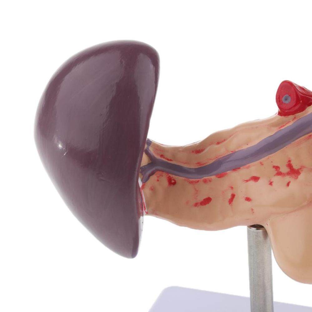 Human Pancreas Duodenum Spleen Anatomical Model / Pancreas Spleen ...