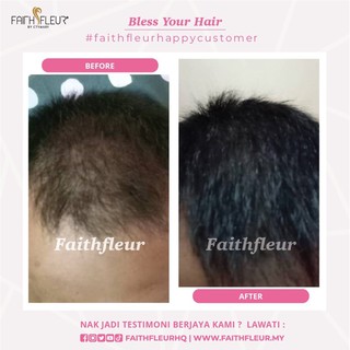 Tonic Hair & Scalp (150ml ) Faith Fleur| Lebatkan Rambut| Tumbuhkan ...