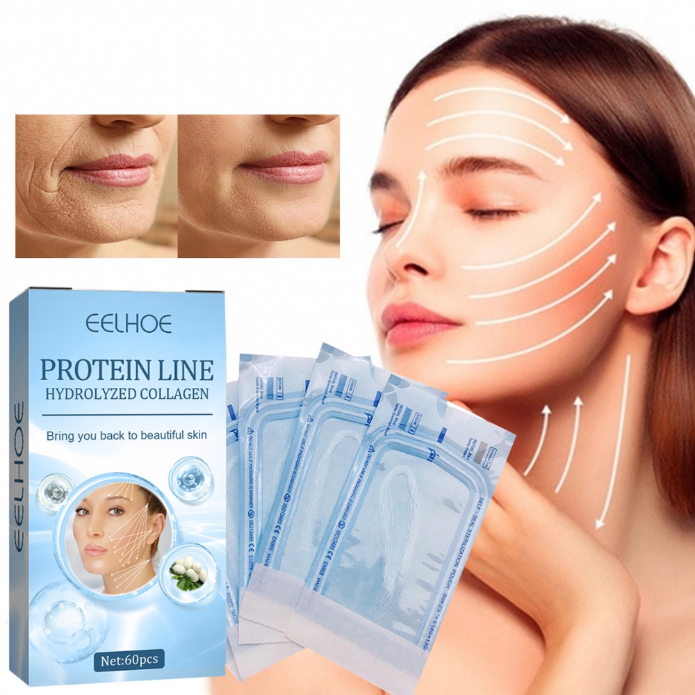 5Bags/60Pcs Protein Face Lifting Thread Absorbable Gold Protein Line ...