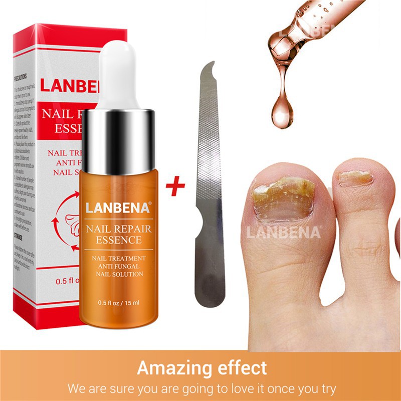 LANBENA Nail Repair Essence Oils Serum Fungal Nail Treatment Remove ...