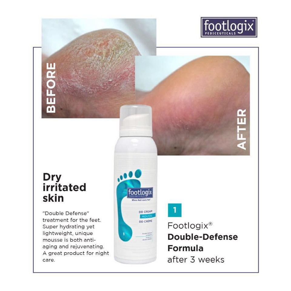 Footlogix DD Cream Mousse ( 125 ml ) | Shopee Malaysia