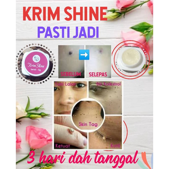 (krim shine)READY STOK,KRIM BUANG TAHI LALAT,KUTIL,KETUAT, BIJI ...