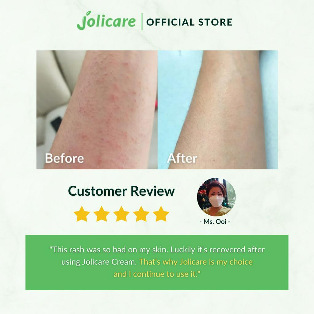 Jolicare™ Official Store, Online Shop | Shopee Malaysia