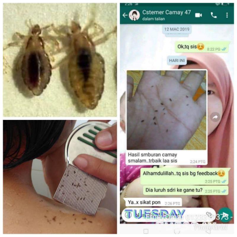 Camay @ lice comb/Sikat kutu Ubat KUTU Rambut @ kutu kucing HQ 100% ...