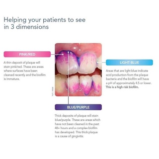 Gc Tri Plaque Gel / Disclosing Solution / Germicidal Identification ...
