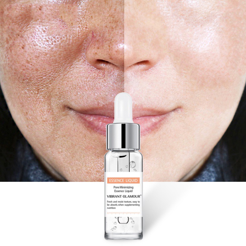 Salicylic Acid Solution Remove Pimples Blackheads Pores Shrinking ...