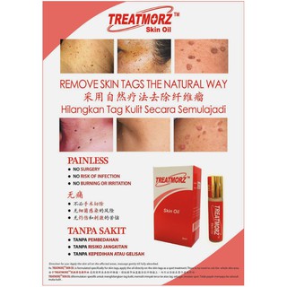 TREATMORZ SKIN OIL FOR SKIN TAGS 8ML 0.28OZ (NEW PACKAGING) | Shopee ...