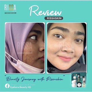 RISSA SKIN ORIGINAL HQ ( PREMIUM SKINCARE BIRD NEST ) | Shopee Malaysia