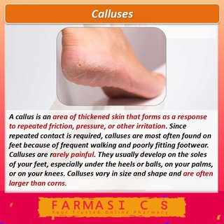 Collomack Topical Solution 10ml EXP: 10/2023 [ 鸡眼敌 / Treatments for ...